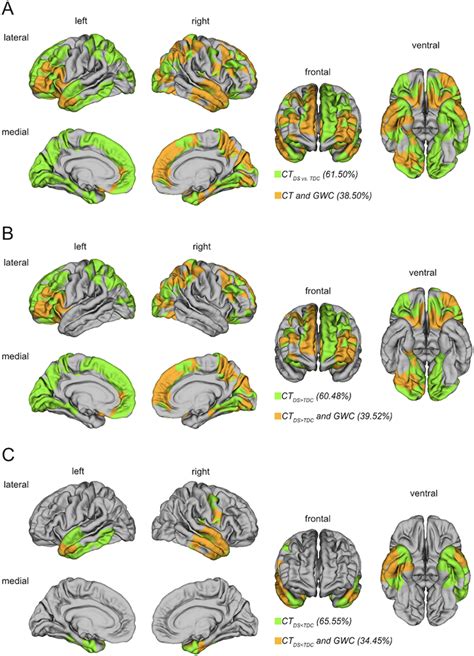 fig ure 2 spatial overlap between the patterns of between group