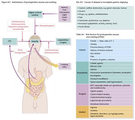 14 Postoperative Nausea And Vomiting Pocket Dentistry