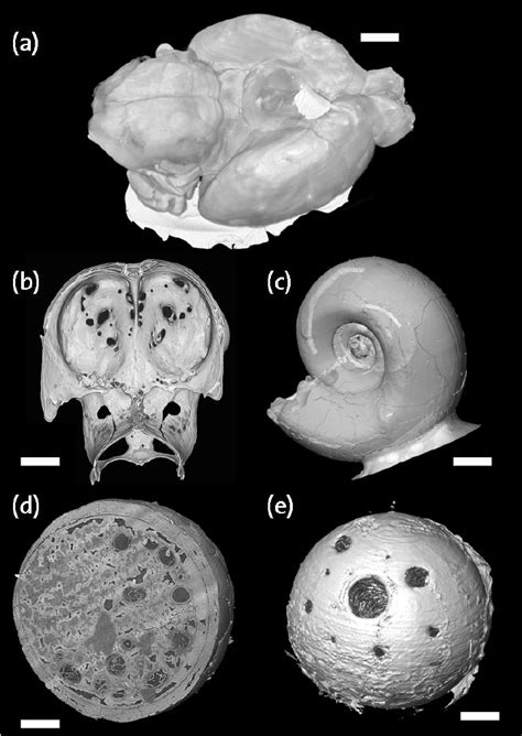 Hierarchical Multimodal X Ray Tomographic Microscopy At Tomcat A