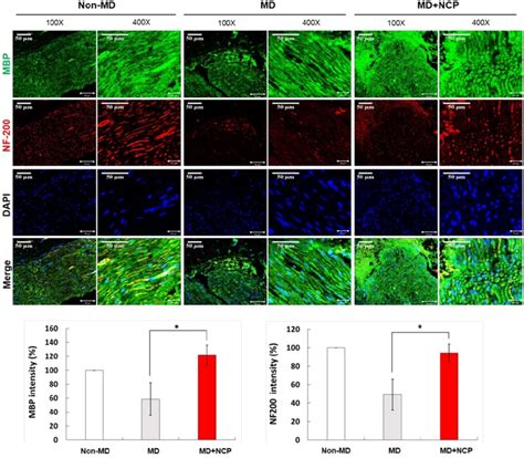 Immunofluorescence In Neural Tissue And Mbp And Nf 200 Intensity In