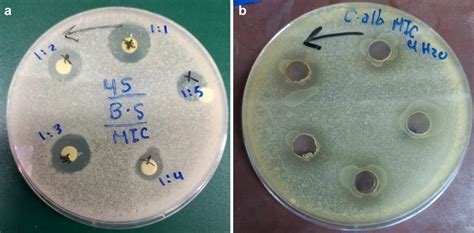 In Vitro Evaluation Of The Antimicrobial Activity Of Aqueous And Ethanolic Extracts Of Four