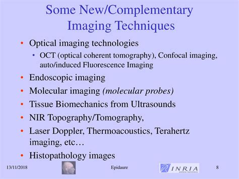 Epidaure Medical Imaging And Robotics Ppt Download