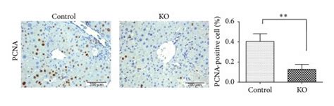 Knockout of PP Acα suppressed hepatocyte proliferation and enhanced Download Scientific Diagram
