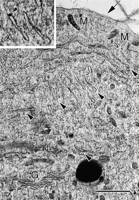 Subcellular Structure And Organization Of Sympathetic Neurons Digital