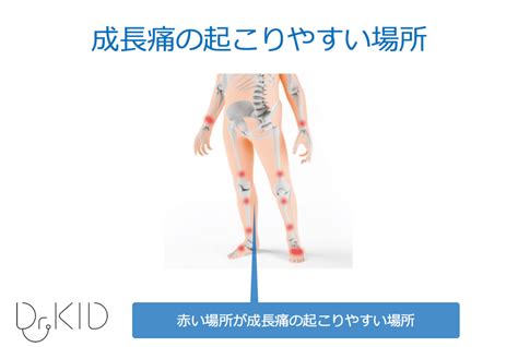 こどもの成長痛について解説しますDr KIDの小児科クリニック