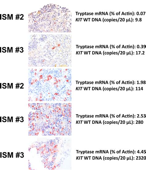 Detection Of Cd45⁺ Human Cells In The Bm Of Nsgscf Mice By Download Scientific Diagram