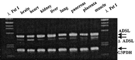 Cdisc Subject Level Analysis Dataset Semantic Scholar