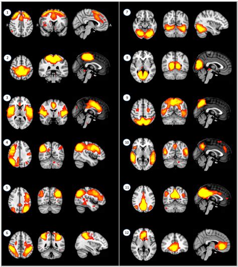 Twelve Spatially Independent Resting State Related Functional Networks