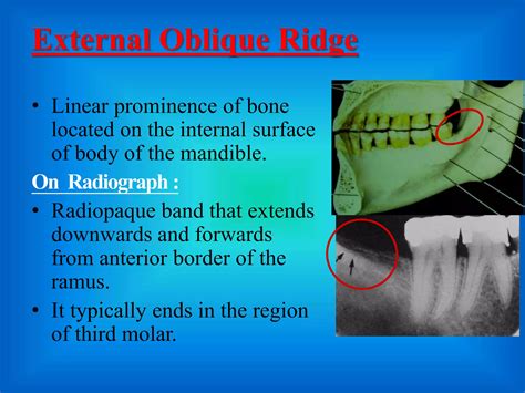 Mandibular Landmarks Of Radiograph Pptx