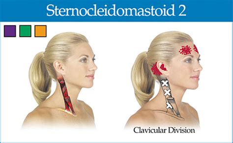 SCM Trigger Points Orleans Core Elements