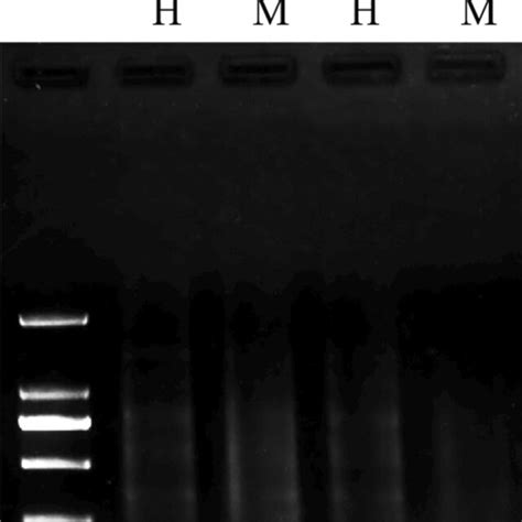 Electropherogram Of Selective Amplification H Ecori Hpaii Download Scientific Diagram