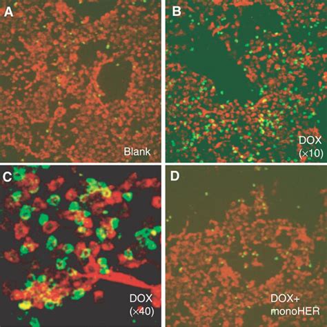 Immunofluorescence Microscopy Of Neutrophil In Green Adhesion After