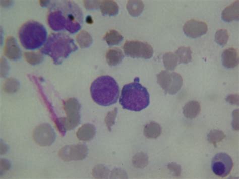 Flickriver Photoset Eritropoese By Dione1986