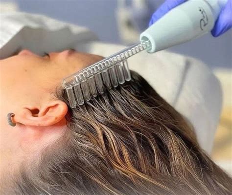 Centro ¿qué Es La Alta Frecuencia Capilar La Alta Frecuencia Capilar