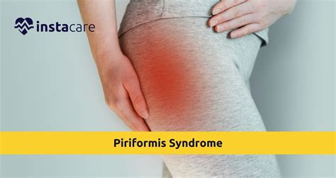 What You Must Know About Piriformis Syndrome