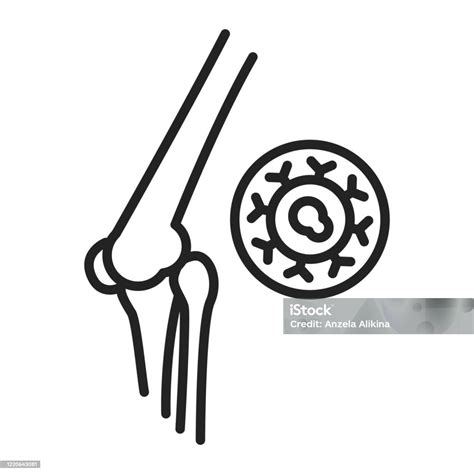 뼈 암 검은 선 아이콘입니다 악성 신 생물 종양학 격리된 벡터 요소입니다 웹 페이지 모바일 앱 프로모션에 대한 개요 Pictogram 개념에 대한 스톡 벡터 아트 및 기타