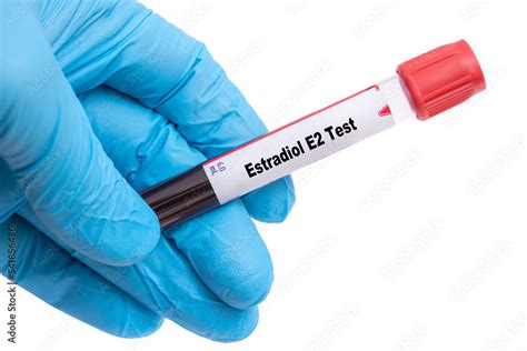 Estradiol E2 Test Medical Check Up Test Tube With Biological Sample