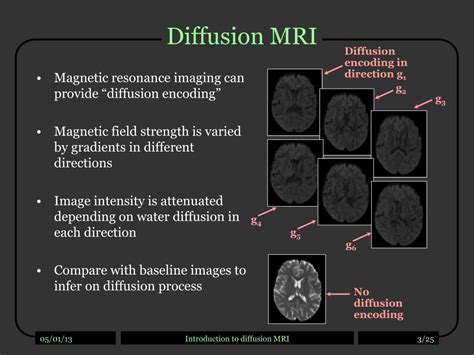 Ppt Introduction To Diffusion Mri Powerpoint Presentation Free