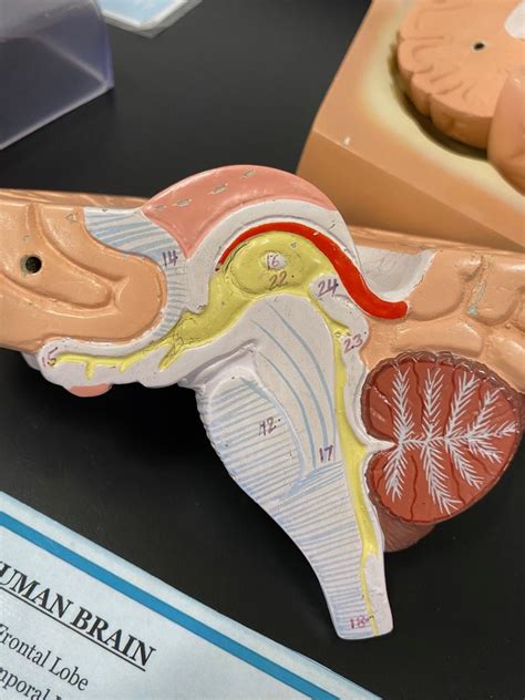 Brain Diagram Quizlet