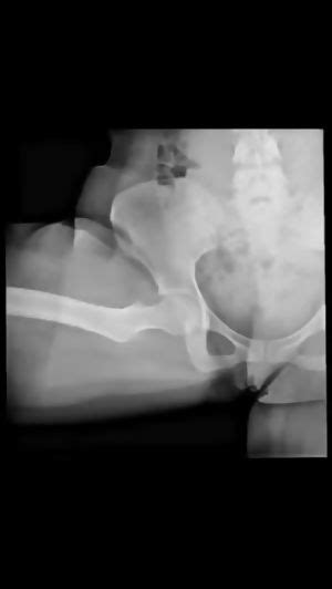 Dynamic Digital Radiography DDR Reddit NSFW