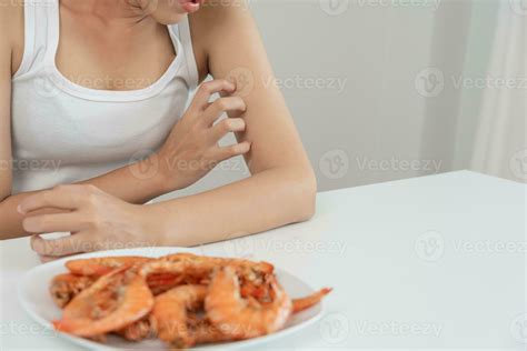 Food Allergies Women Have Reactions Itching And Redness After Eating