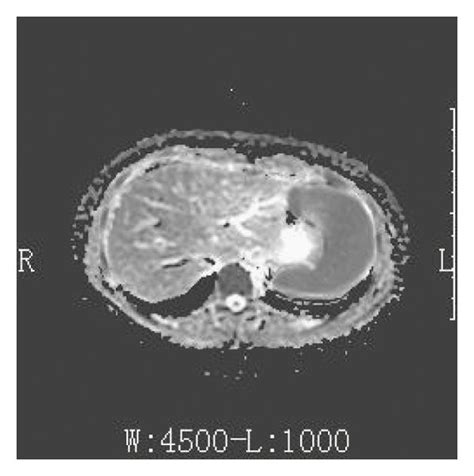 ADC Images A F0 B F1 C F2 D F3 E F4 Download Scientific Diagram