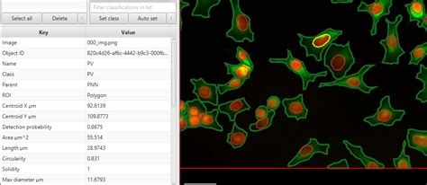 combining stardist and cellpose in the same script image analysis