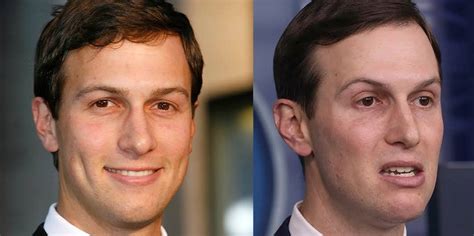 What Happened To Jared Kushners Face — Do Before After Pics Show Plastic Surgery Or Botox
