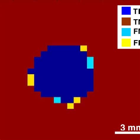 Model Fit Error Map For A Typical Ablation The Error Map Was Obtained Download Scientific