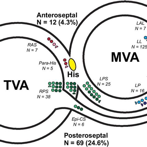 Distribution Of Accessory Atrioventricular Pathways The Number And