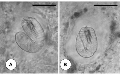 Chordodes Janovyi N Sp Cysts Recovered From An Experimentally Download Scientific Diagram
