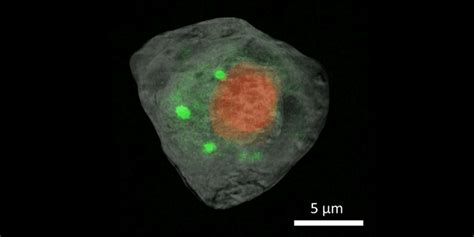 Pioneering The Single Cell Imaging Frontier With Advanced X Ray Techniques Lab Manager