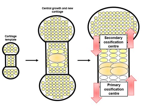 A Key Molecule For Embryonic Bone Development Is Dysregulated In Cancer