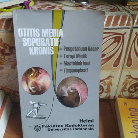 Jual Otitis Media Supuratif Kronis Pengetahuan Dasar Terapi Metrik Mastoidektomi
