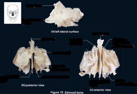 Ethmoid Bone Diagram Quizlet