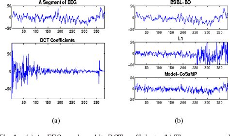 figure 1 from compressed sensing of eeg for wireless telemonitoring