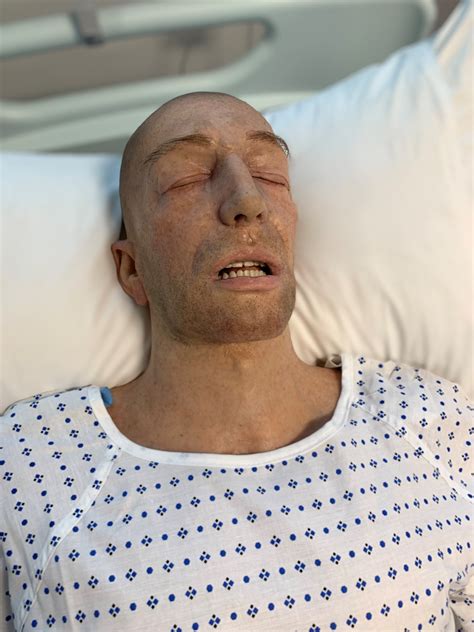 Adult Simulation Lab Skillsacquisitionandsimulation