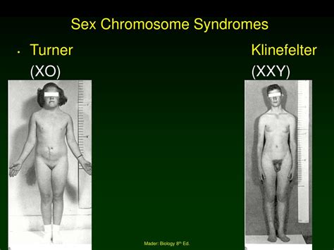 Ppt Chromosomal Patterns Of Inheritance Powerpoint Presentation Free