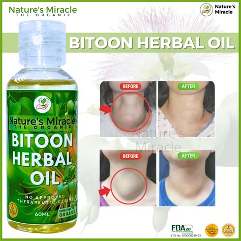Bitoon Herbal For Bukol Original Bitoon Herbal Oil Original Bitoon Herbal Oil Alingatong Miracle