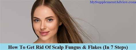 How To Get Rid Of Scalp Fungus Flakes In Steps Supplementox