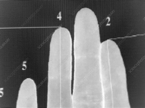 Ring Finger And Sexual Attraction Stock Image C Science Photo Library