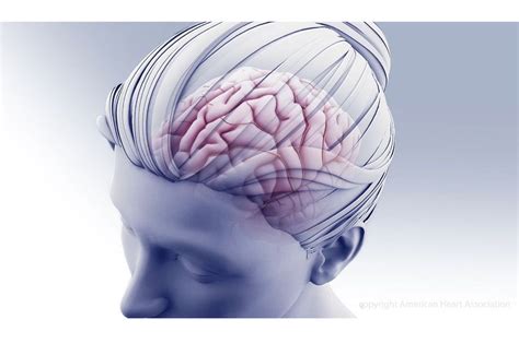 Recognizing Stroke Symptoms Early Can Save Lives American Heart