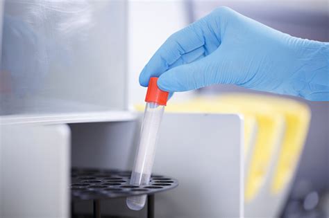 실험실에서 의학 연구 현대 장비를 사용하여 의료 샘플로 작업하는 실험실의 과학자 분석을위한 실험실 의료 장비 의료 기기 코로나