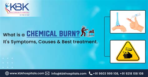 What Is A Chemical Burn Symptoms Causes And Best Treatment