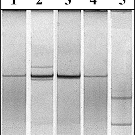 Electrophoregramm Of Extrachromosomal DNA Extracted From E Horticola
