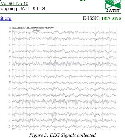 figure 3 from analysis and classification of brain signals using dwt