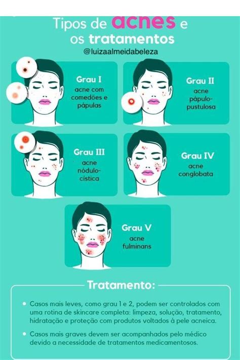 Tratamento De Papulas De Acne Estética Facial Tipos De Acne E Seus