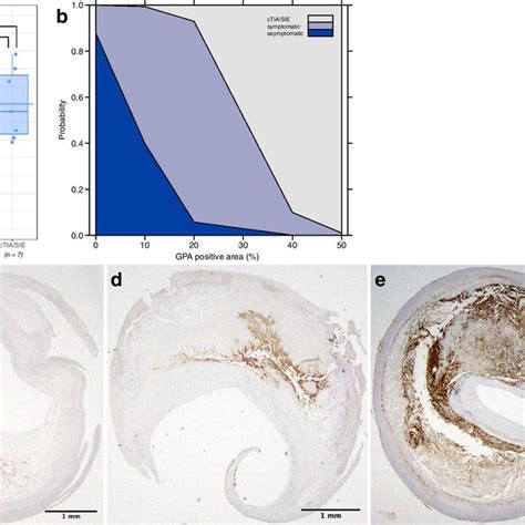 Correlation Between Intraplaque Hemorrhage In Carotid Plaque And Download Scientific Diagram