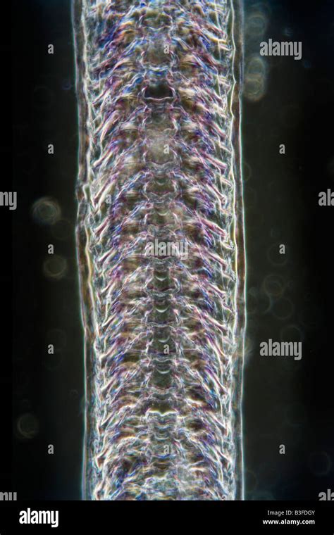 In Slide Radula In Molluscs
