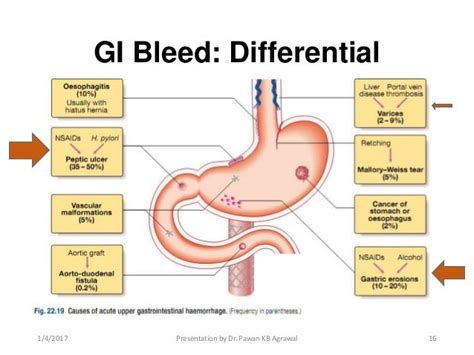 Gastrointestinal Bleeding
